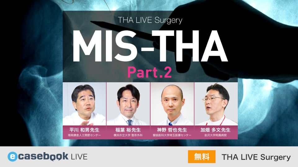 VIDEO: MIS-THA 第2部 Mini-WatsonJones（OCM）アプローチ | Orthopedics | e-casebook LIVE